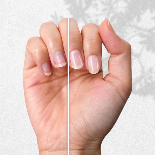 Weak, Brittle Nails and Damaged Cuticles – Onsen Secret